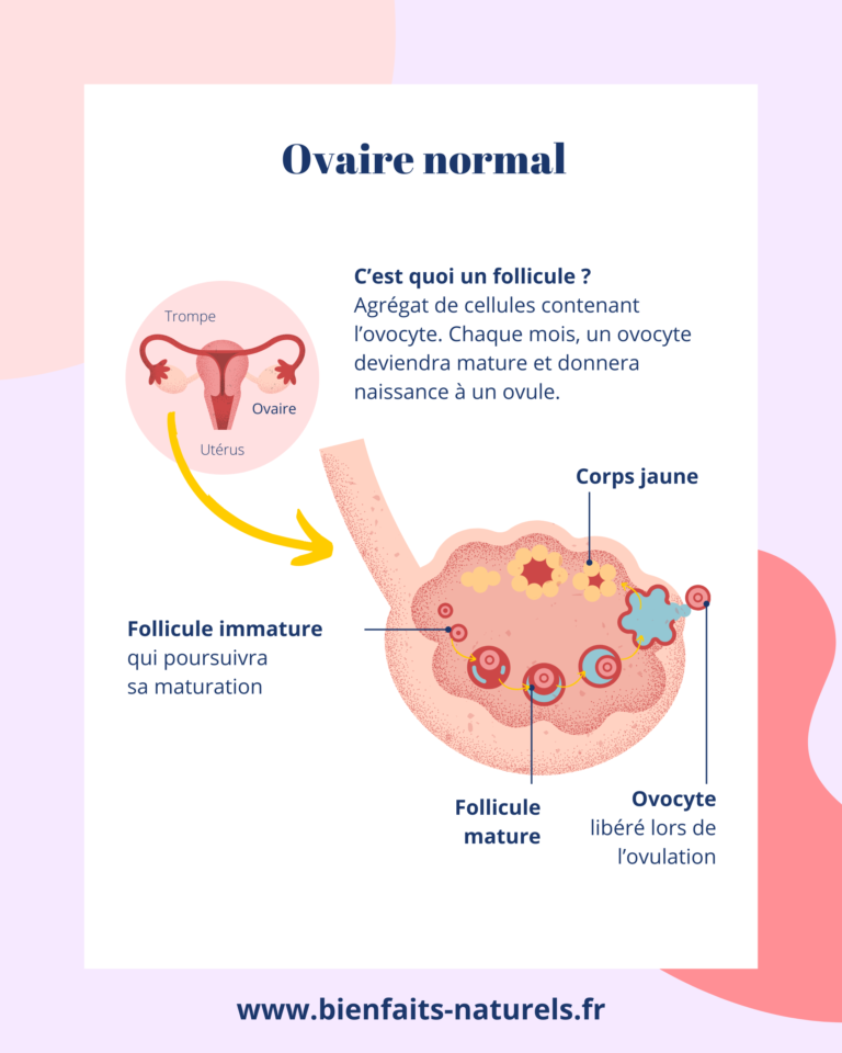Les symptômes du SOPK